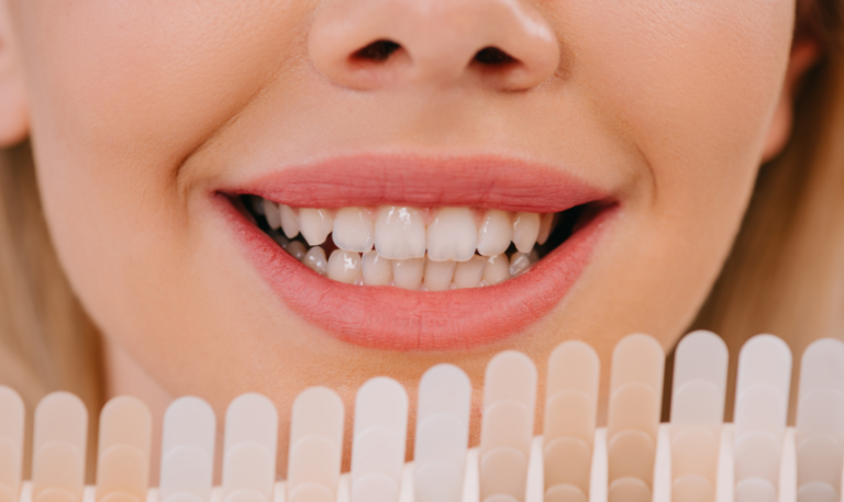 Foods and Drinks To Avoid After Zoom Teeth Whitening